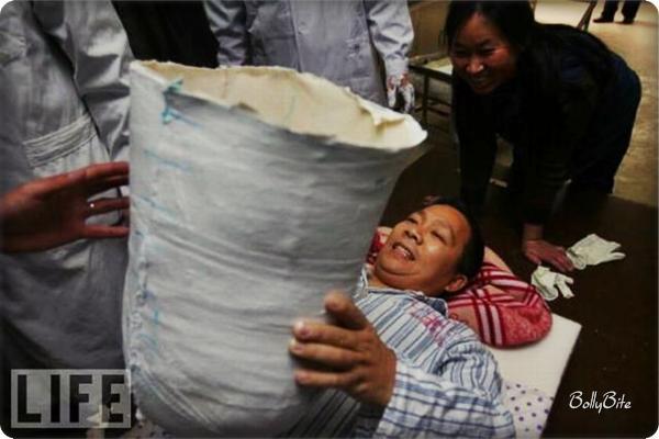 Neighbor Too Loud? Consider the Case of Peng Shuilin